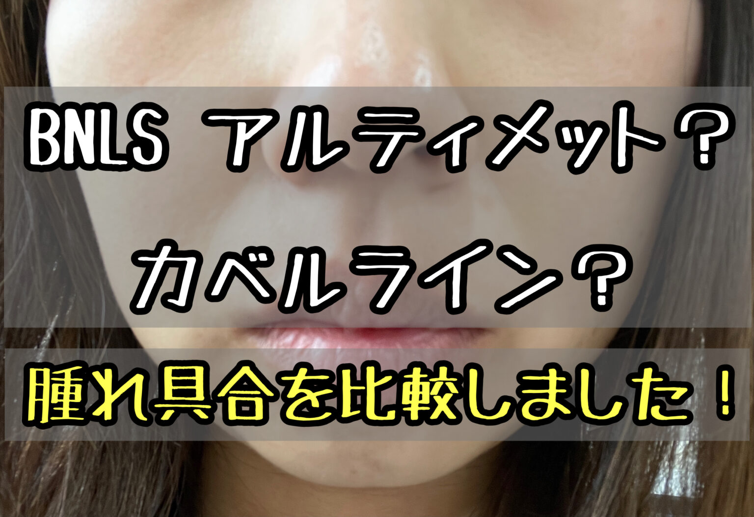 BNLS ultimate(BNLSアルティメット)とカベルライン(カベリン)の効果！打ちまくってきた体験談ブログ！ | ＊メメコメモ＊